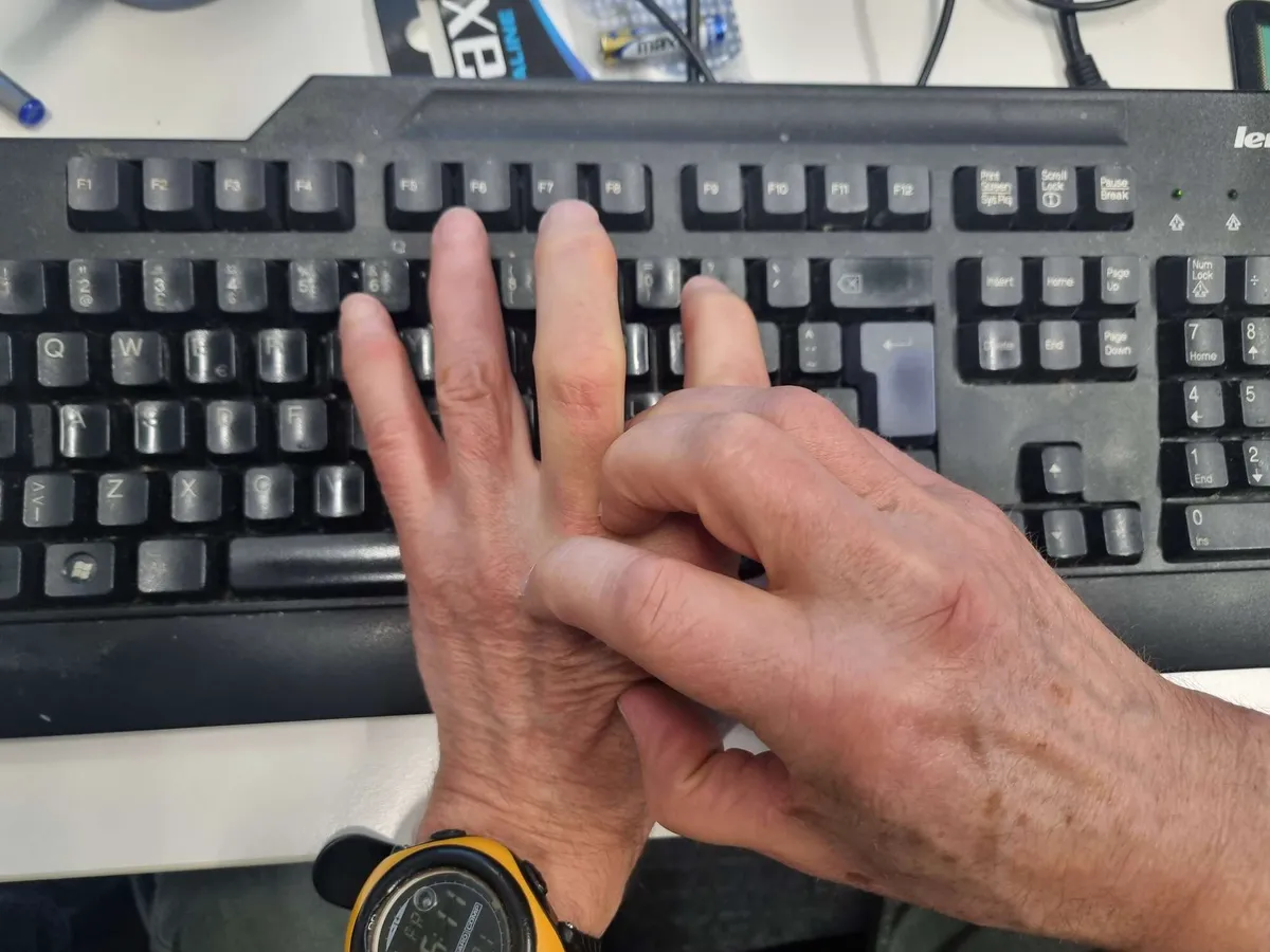 Syyhy voi maksaa perheelle satoja euroja – Viranomaiset toivovat ...