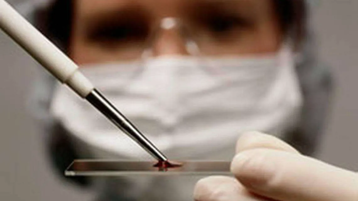 Uusi verikoe voisi löytää syövän hyvin varhain | Tekniikka&Talous